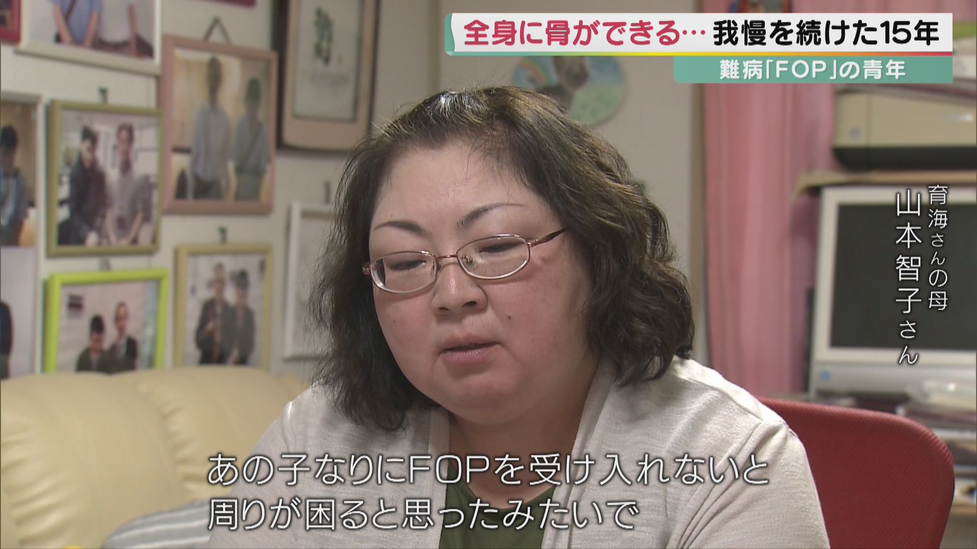 全身の筋肉に骨が…難病「FOP」と15年以上闘い続ける青年 体への衝撃がリスク…虫歯の治療も“命がけ” 自らの皮膚を研究に提供 iPS細胞を活用した治療法“一筋の光”に 育海さんが“いま”願う ...