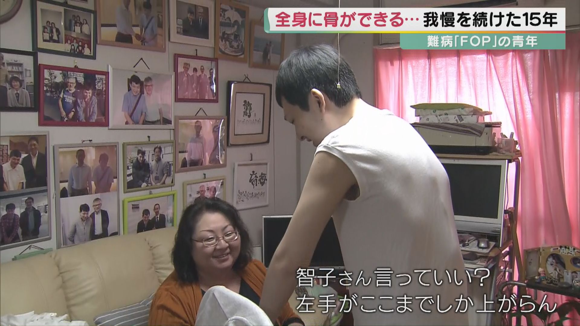 全身の筋肉に骨が…難病「FOP」と15年以上闘い続ける青年 体への衝撃がリスク…虫歯の治療も“命がけ” 自らの皮膚を研究に提供 iPS細胞を活用した治療法“一筋の光”に 育海さんが“いま”願う ...