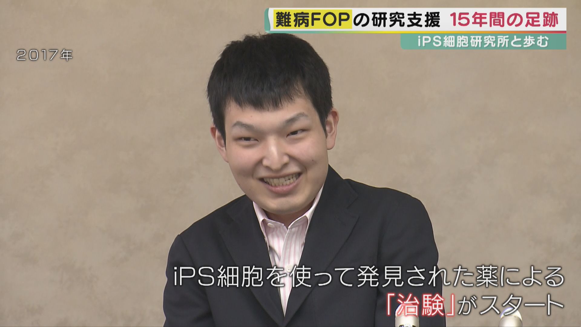 全身の筋肉に骨が…難病「FOP」と15年以上闘い続ける青年 体への衝撃がリスク…虫歯の治療も“命がけ” 自らの皮膚を研究に提供 iPS細胞を活用した治療法“一筋の光”に 育海さんが“いま”願う ...