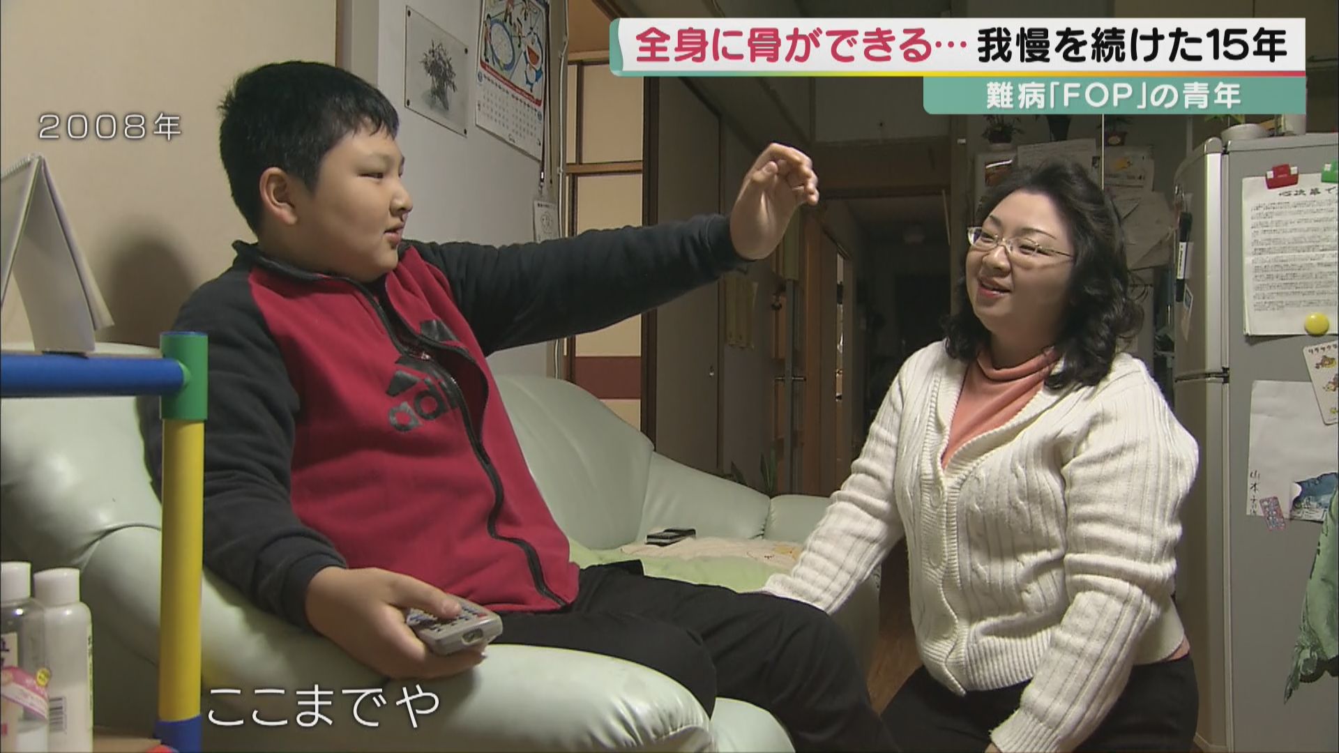 全身の筋肉に骨が…難病「FOP」と15年以上闘い続ける青年 体への衝撃がリスク…虫歯の治療も“命がけ” 自らの皮膚を研究に提供 iPS細胞を活用した治療法“一筋の光”に 育海さんが“いま”願う ...